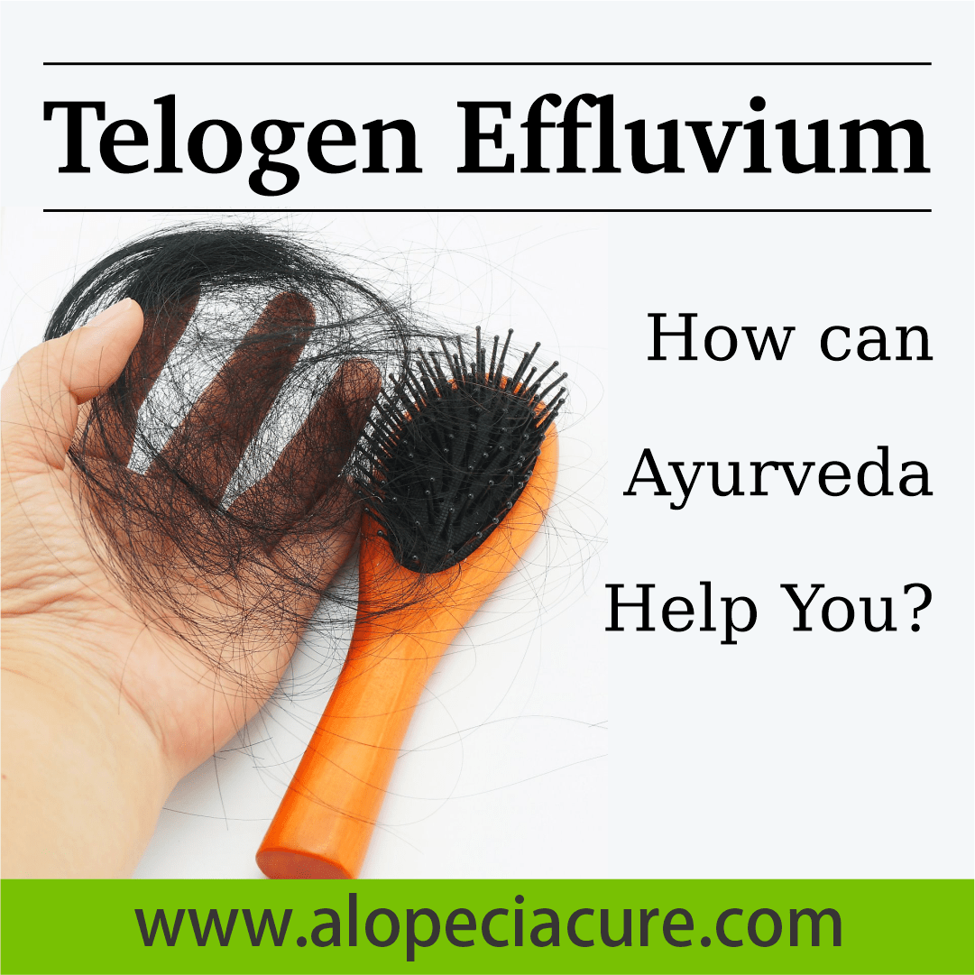 Telogen Effluvium: Ayurvedic Approaches for Hair Restoration | AlopeciaCure