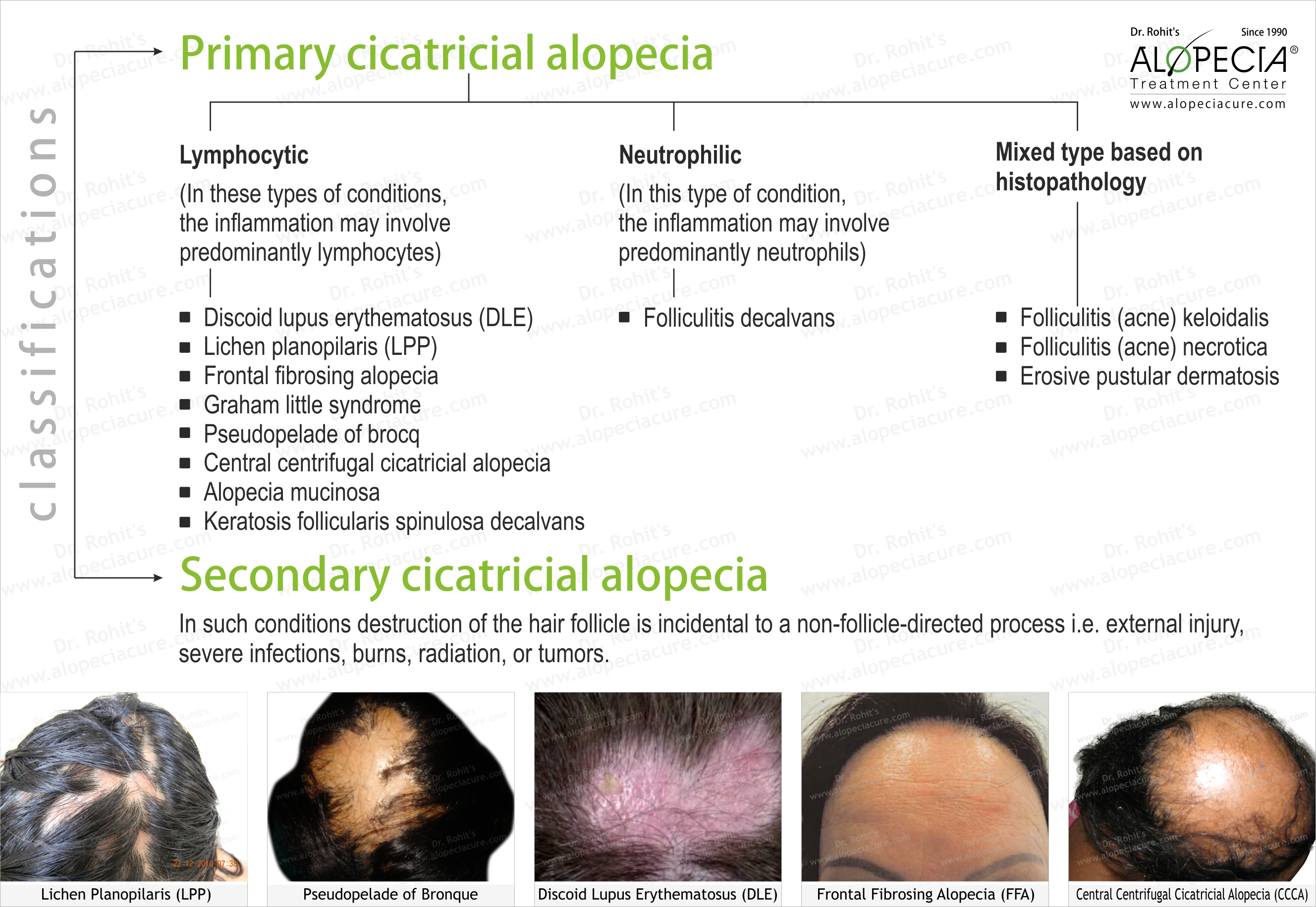 Scarring alopecia (Cicatricial alopecia) - Try Dr Rohit's 100% Natural ...